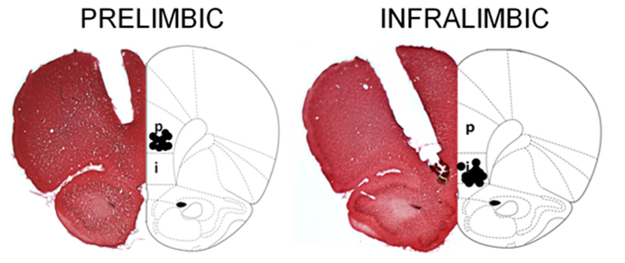 Frontiers | The stressed female brain: neuronal activity in the ...