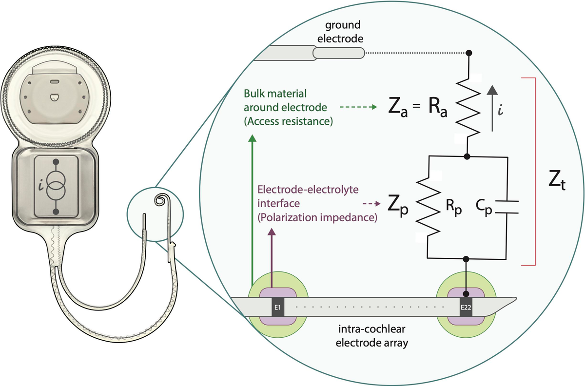 Frontiers | Measuring the Electrical Status of the Bionic Ear. Re ...