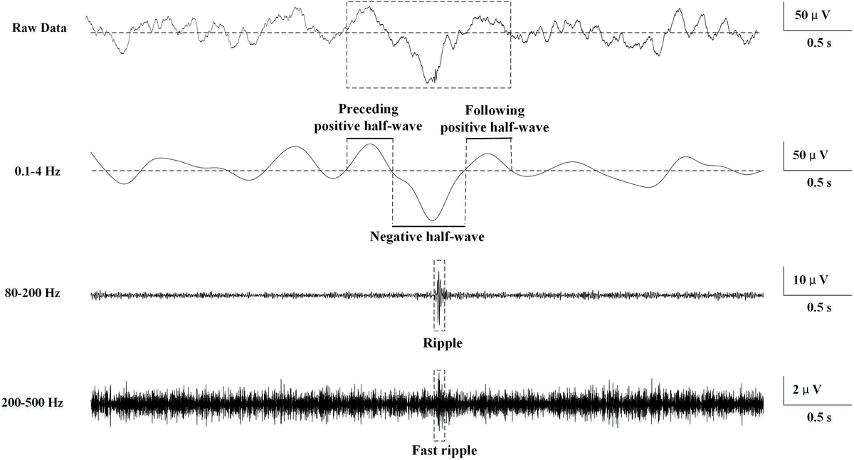 Frontiers | Association Between Interictal High-Frequency Oscillations ...