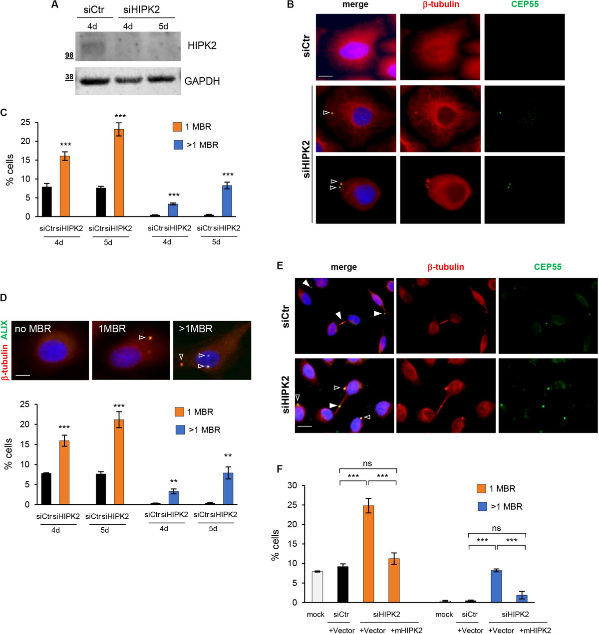 Frontiers | HIPK2 Is Required for Midbody Remnant Removal Through ...