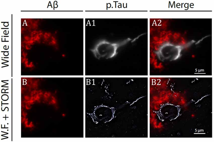 Frontiers | Molecular Imaging of Tau Protein: New Insights and Future ...