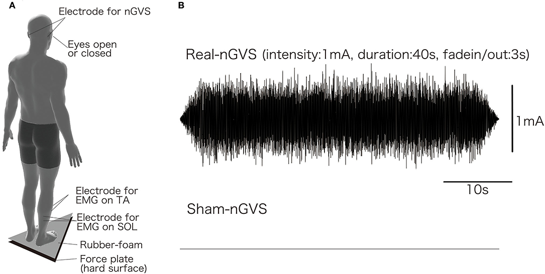 Frontiers | The Effects of Stochastic Galvanic Vestibular Stimulation ...