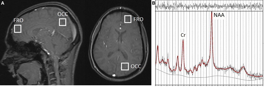 Frontiers | Moderate relationships between NAA and cognitive ability in ...