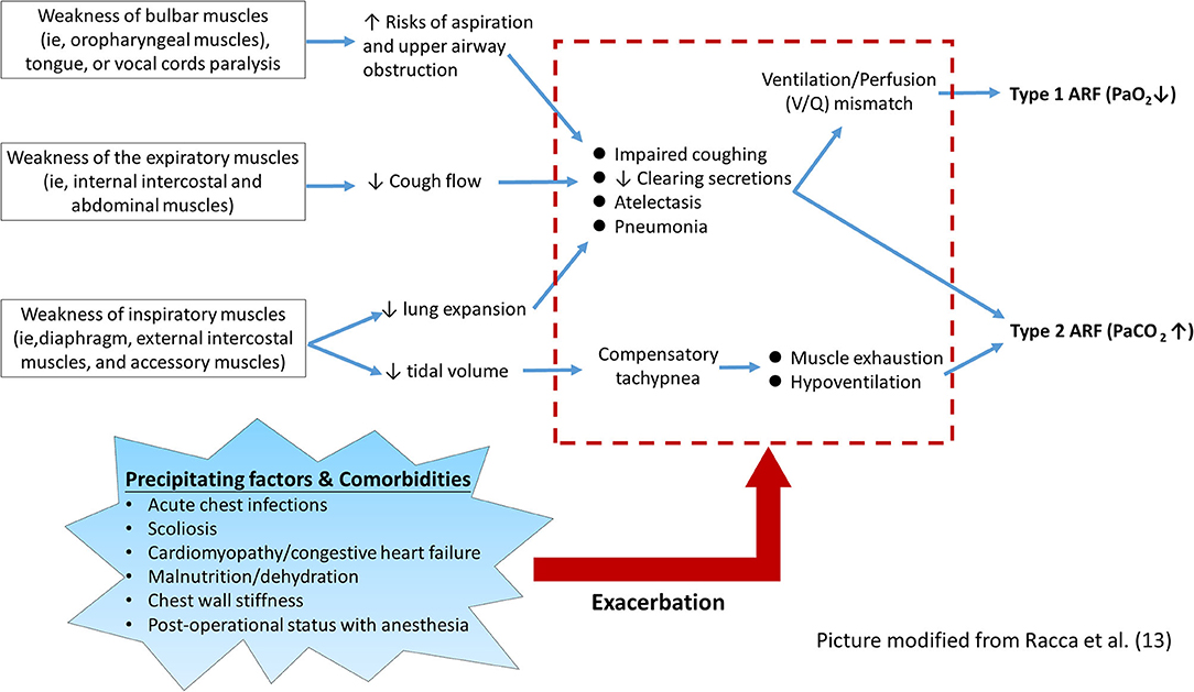 Frontiers | Noninvasive Ventilation and Mechanical Insufflator ...
