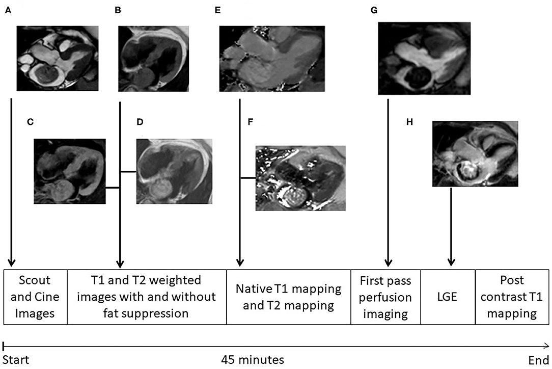 Frontiers | Cardiac Myxomas Show Elevated Native T1, T2 Relaxation Time ...