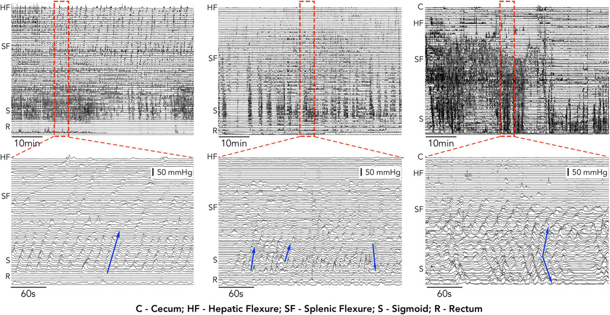Frontiers | Automated Analysis Using a Bayesian Functional Mixed-Effects Model With Gaussian ...