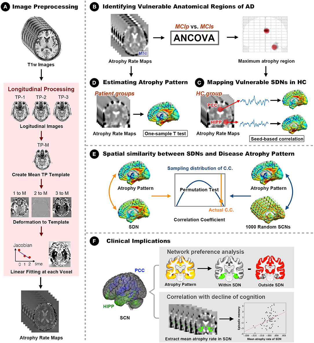 Frontiers | Posterior Cingulate Cortex Network Predicts Alzheimer's ...