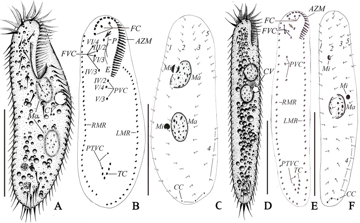 Frontiers | A New Record of Oxytricha granulifera granulifera Foissner ...