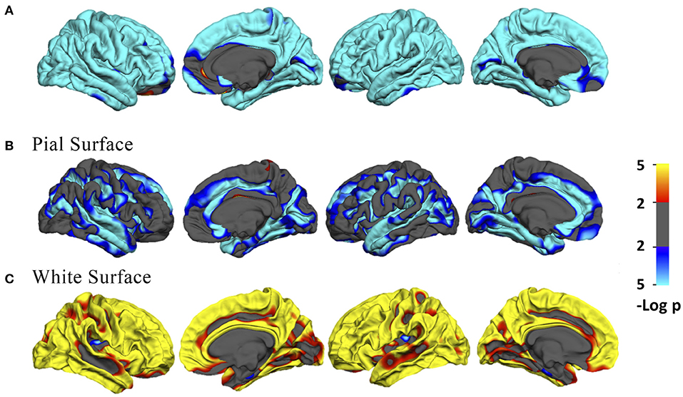 Frontiers | Differential Patterns of Gyral and Sulcal Morphological ...