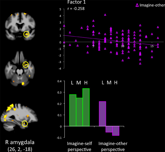 Frontiers | An fMRI study of affective perspective taking in ...