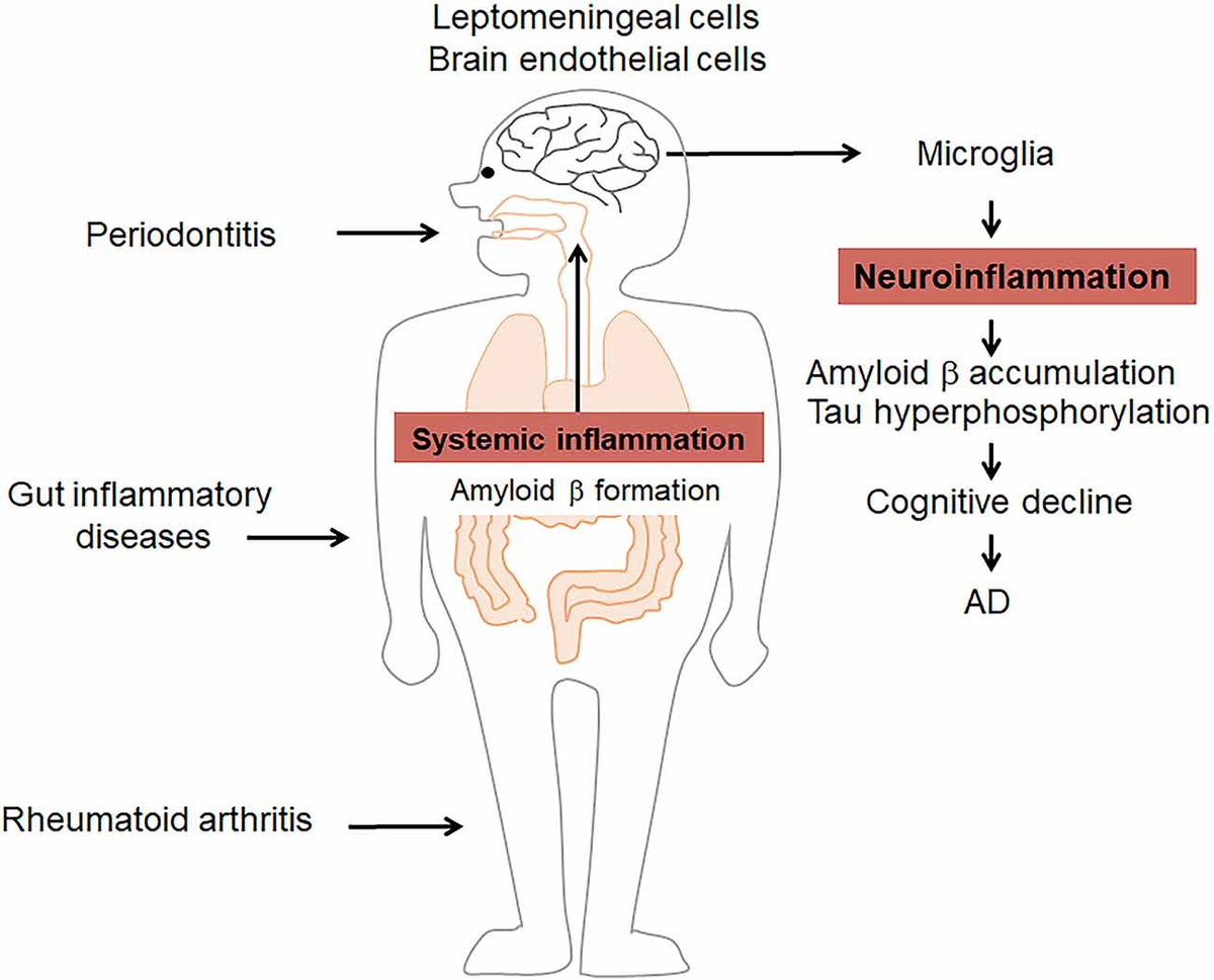 Frontiers | Inflammation Spreading: Negative Spiral Linking Systemic ...