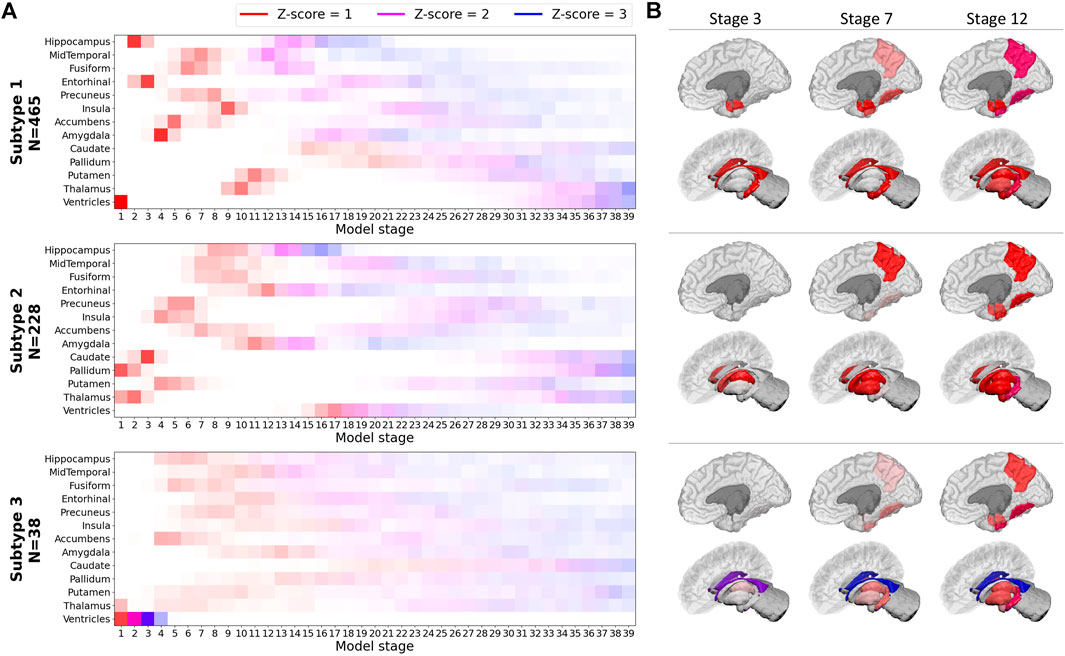 Frontiers | Inter-Cohort Validation of SuStaIn Model for Alzheimer’s ...