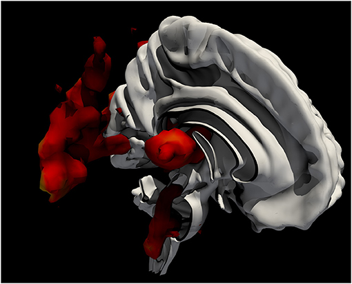 Frontiers | Deconstructing Dizziness