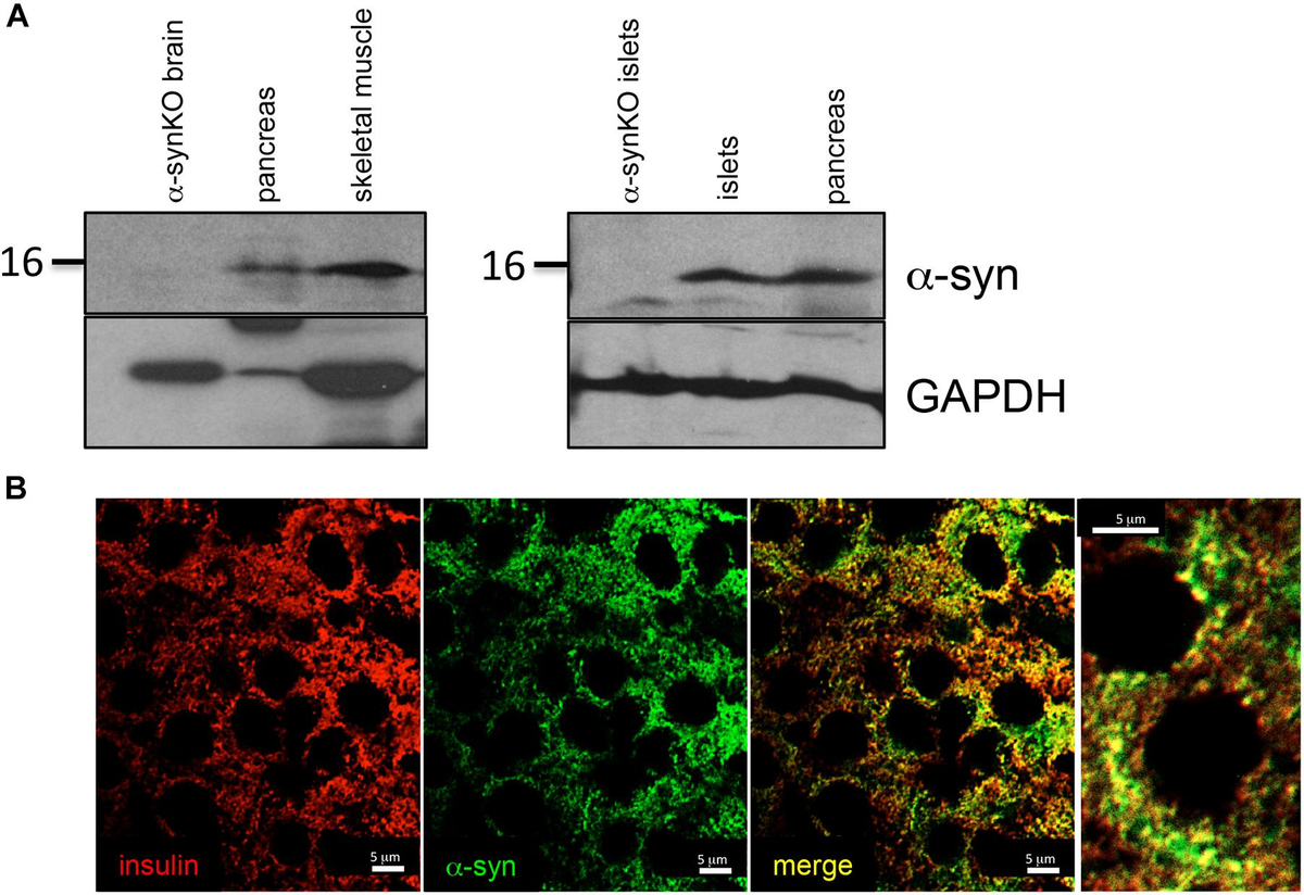 Frontiers | α-Synuclein Regulates Peripheral Insulin Secretion and ...