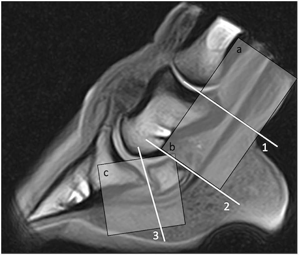 Frontiers | Comparison Between Ultrasonographic and Standing Magnetic ...
