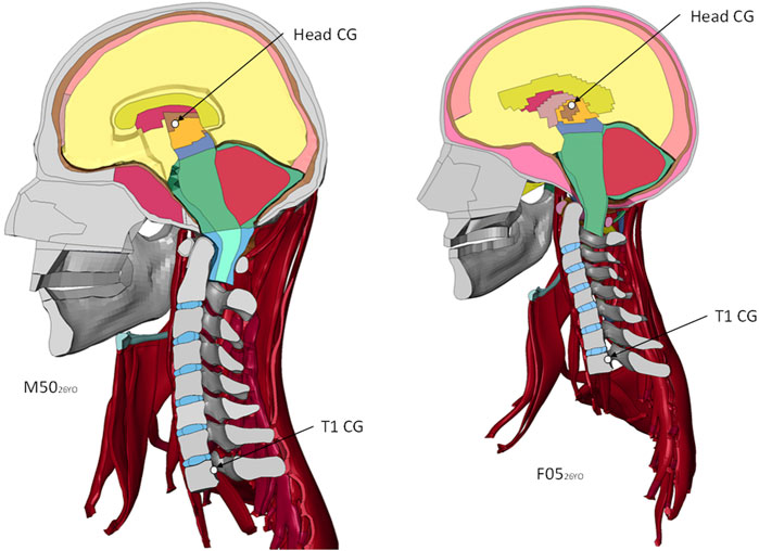 Frontiers | Sex, Age and Stature Affects Neck Biomechanical Responses ...
