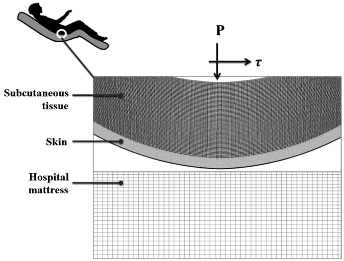 Frontiers | Modeling the Effects of Moisture-Related Skin-Support ...