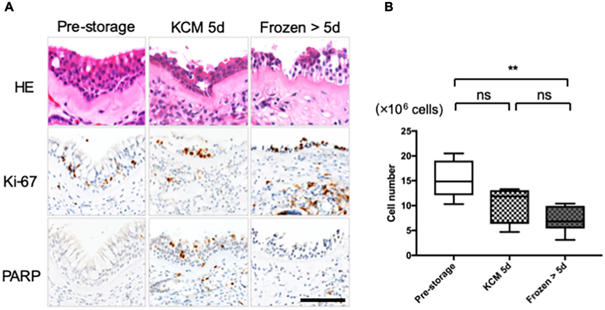 Frontiers | Temporary Storage of the Human Nasal Tissue and Cell Sheet ...