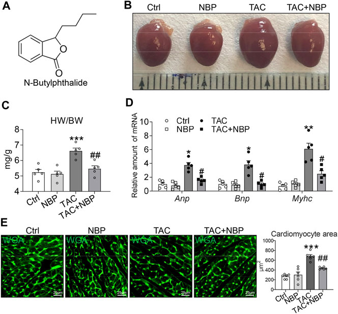 Frontiers | DL-3-n-Butylphthalide Attenuates Myocardial Hypertrophy by ...