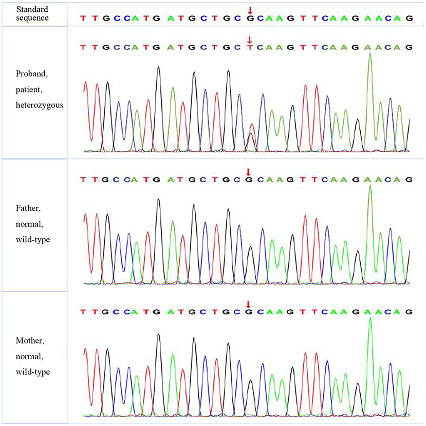Frontiers | Case Report: Identification of Polygenic Mutations by Exome ...
