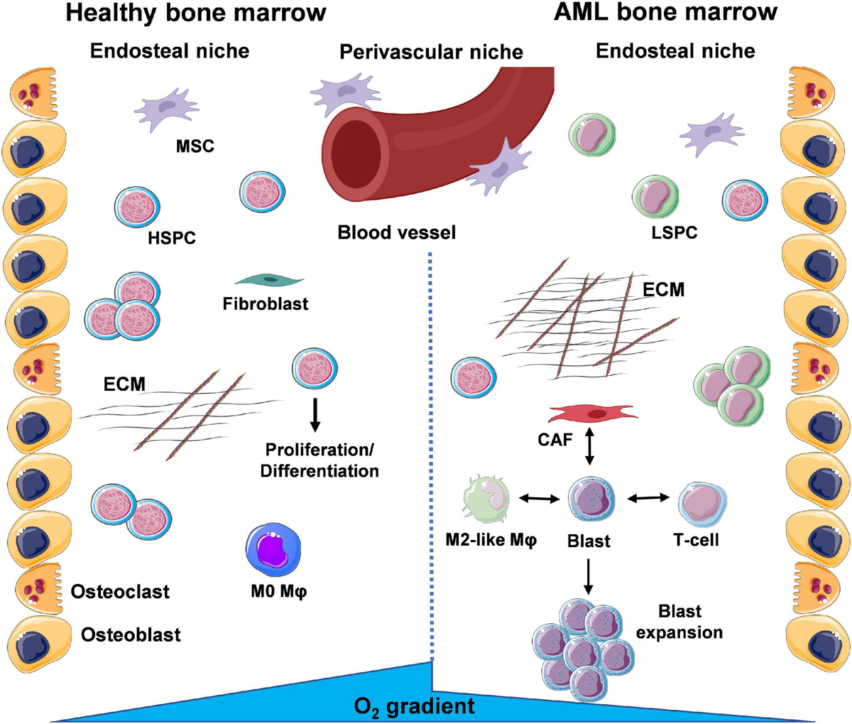 Frontiers | Macrophages in Acute Myeloid Leukaemia: Significant Players ...
