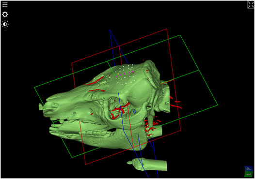 Frontiers | Navigated, Robot-Driven Laser Craniotomy for SEEG ...