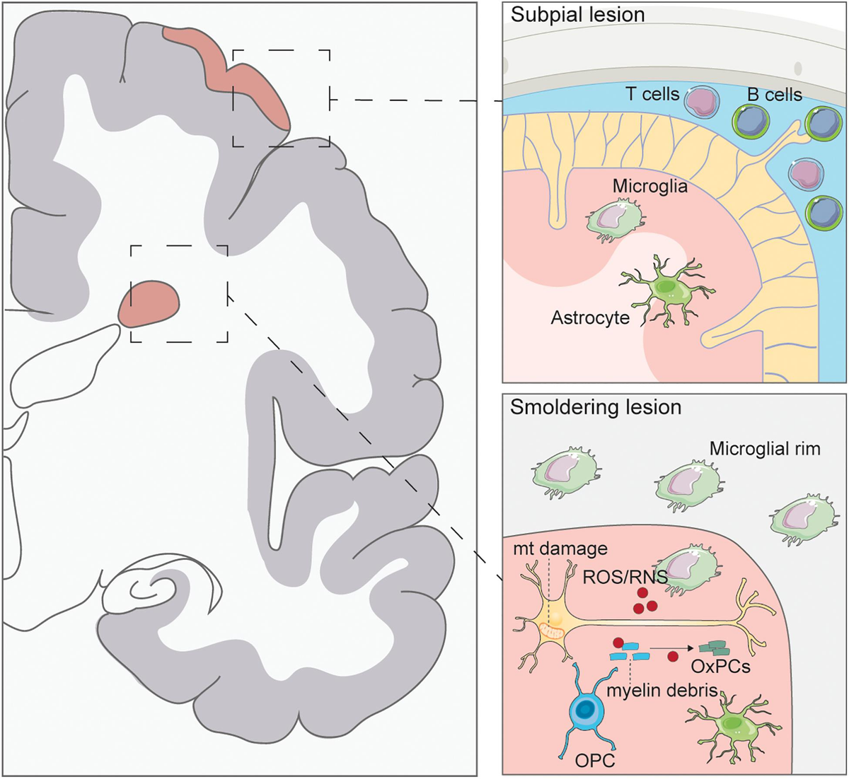 Frontiers | Stem Cell Therapies for Progressive Multiple Sclerosis