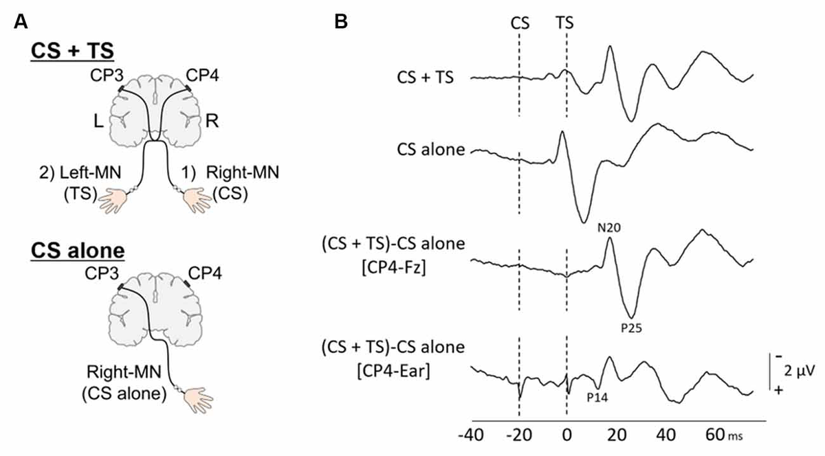 Frontiers | Contralateral and Ipsilateral Interactions in the ...