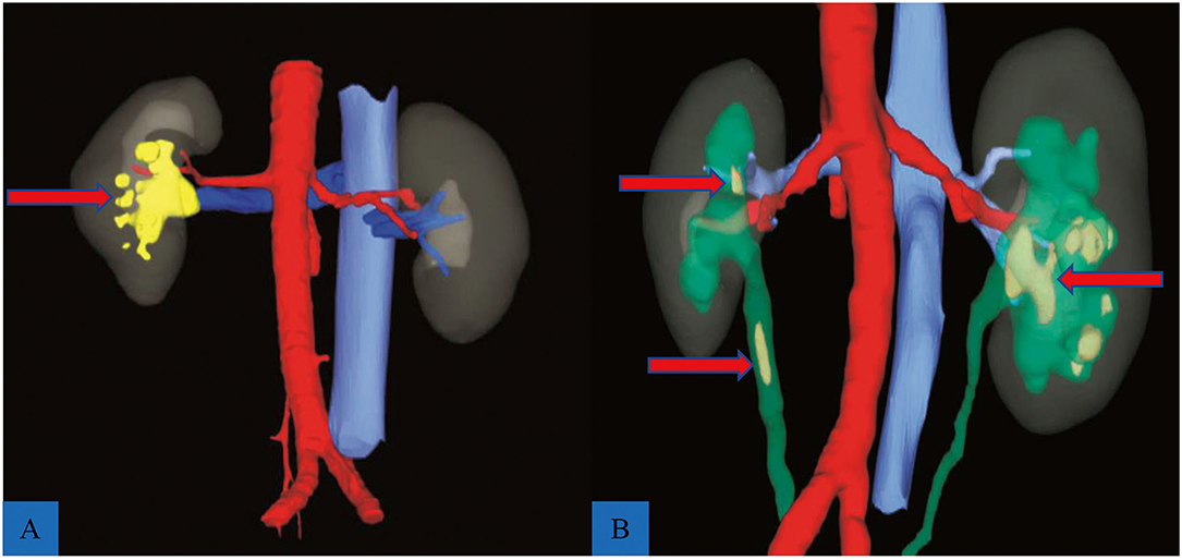 Frontiers | Assessment of Three-Dimensional Reconstruction in ...