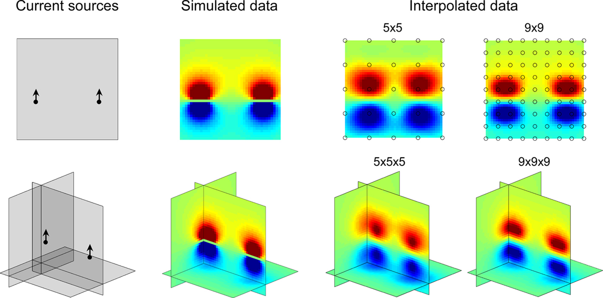 Frontiers | NeuroMap: A Spline-Based Interactive Open-Source Software ...
