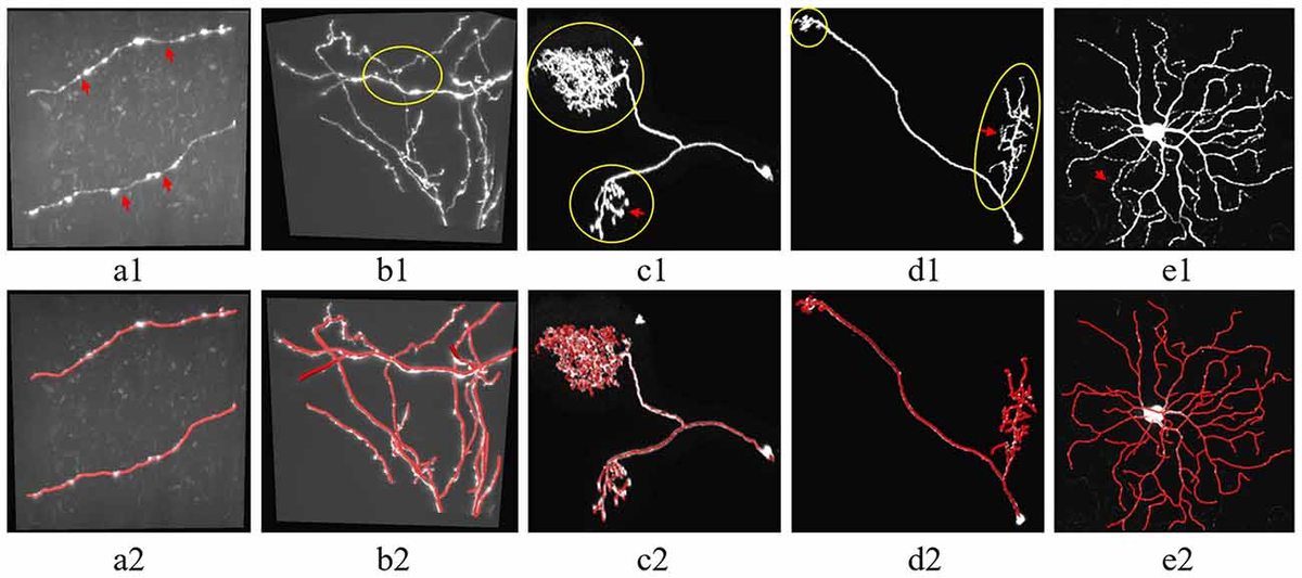 Frontiers | Automated Neuron Tracing Using Content-Aware Adaptive Voxel Scooping on CNN ...