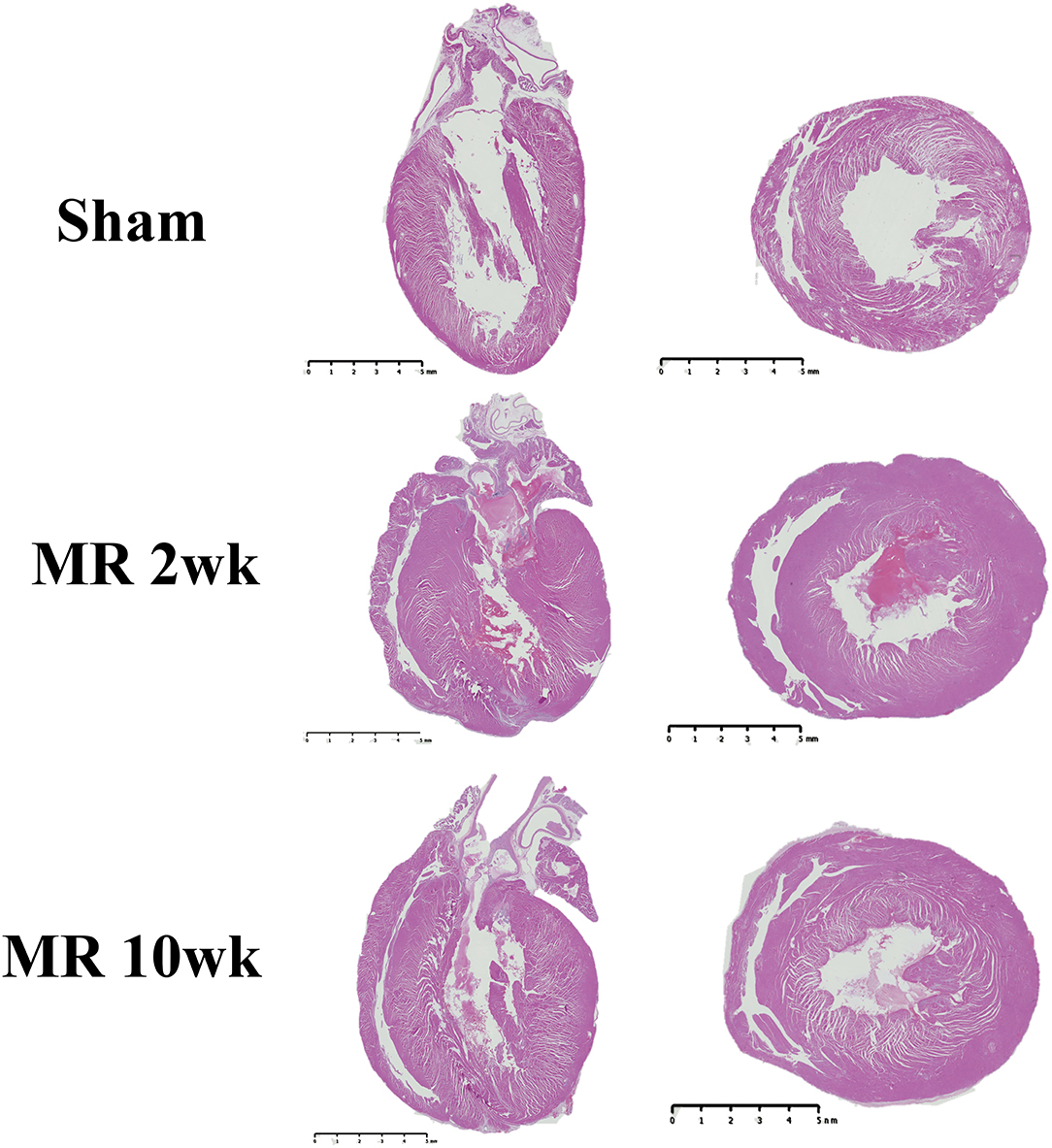 Frontiers | Ultrastructural Adaptation of the Cardiomyocyte to Chronic ...