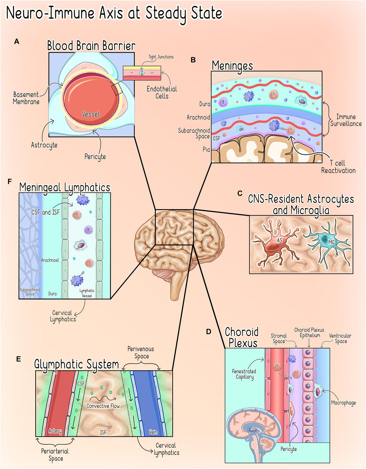 Frontiers | Neuroinflammation in Autoimmune Disease and Primary Brain ...
