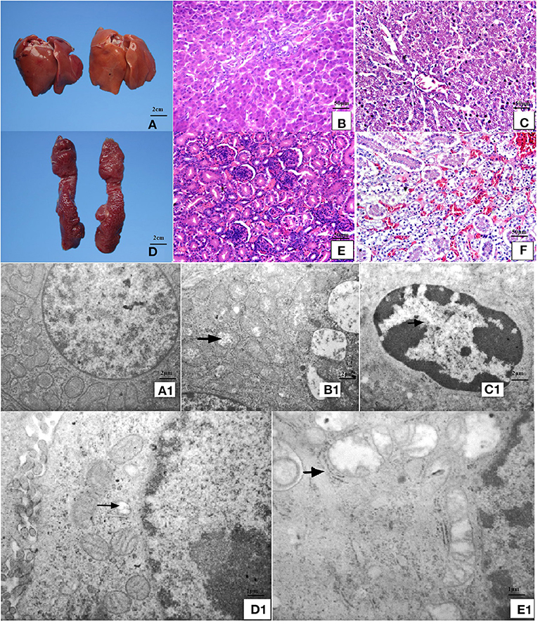 Frontiers | Methionine Deficiency Affects Liver and Kidney Health ...
