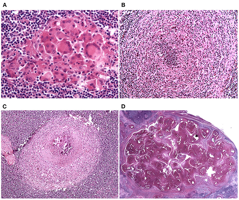 Frontiers | Mycobacterium microti Infection in Wild Boar (Sus scrofa ...
