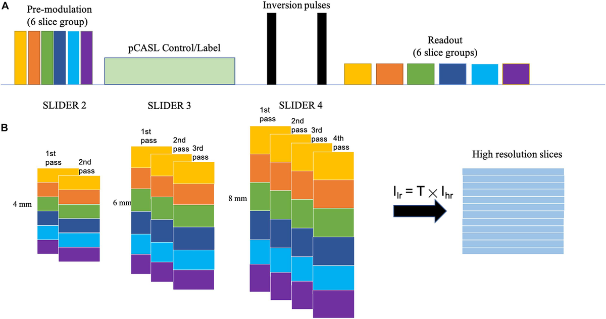 Frontiers | Super-Resolution Arterial Spin Labeling Using Slice ...