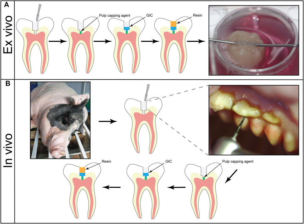 Frontiers | Experimental Pulp-Capping Agent Radiopaque Dicalcium ...