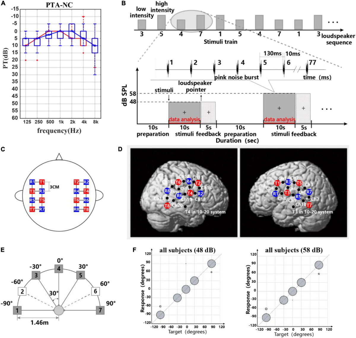 Frontiers | Cerebral Representation of Sound Localization Using ...