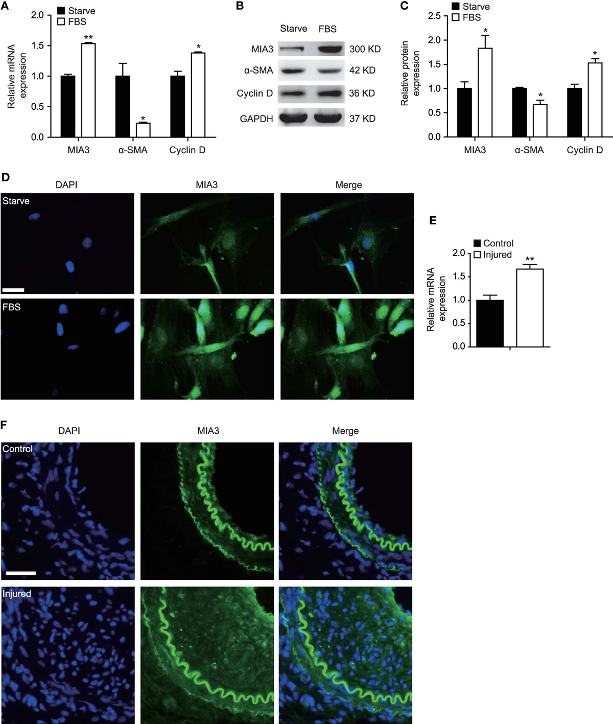 Frontiers | MIA SH3 Domain ER Export Factor 3 Deficiency Prevents ...