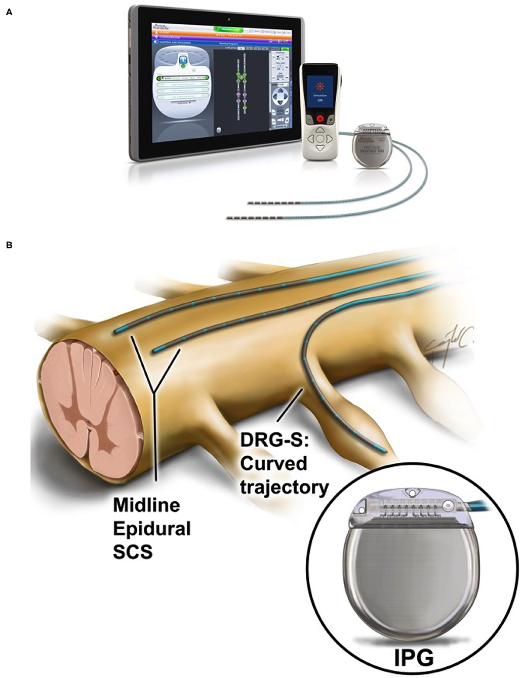 Frontiers | Magnetically Guided Catheters, Micro- and Nanorobots for ...