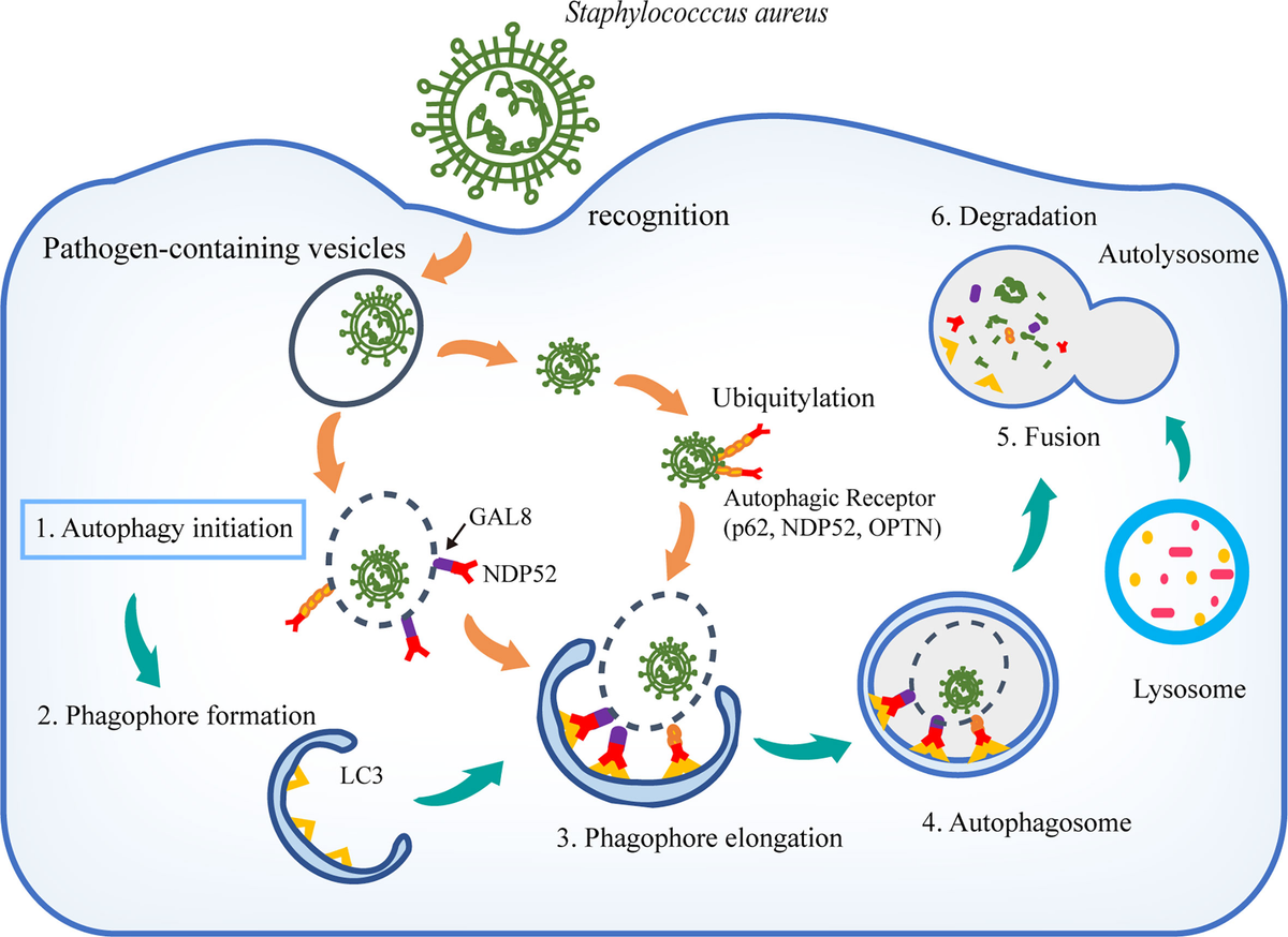Frontiers | Autophagy in Staphylococcus aureus Infection