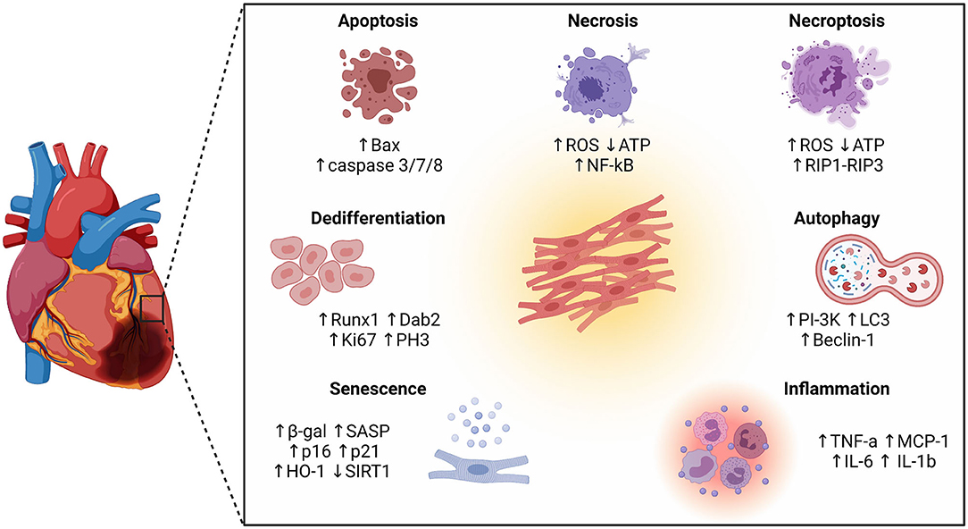 Frontiers | Cardiomyocytes Cellular Phenotypes After Myocardial Infarction