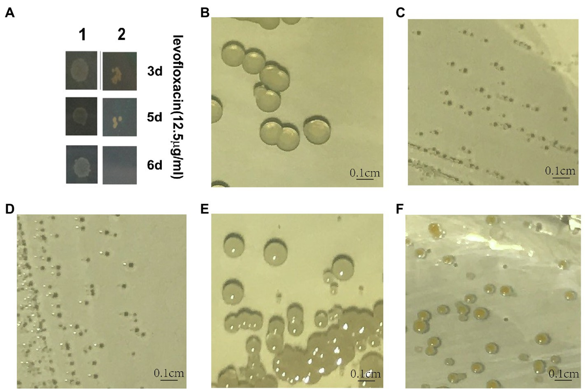 Frontiers | Involvement of Small Colony Variant-Related Heme ...