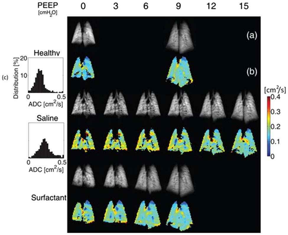 Frontiers | New Frontiers in Functional and Molecular Imaging of the ...