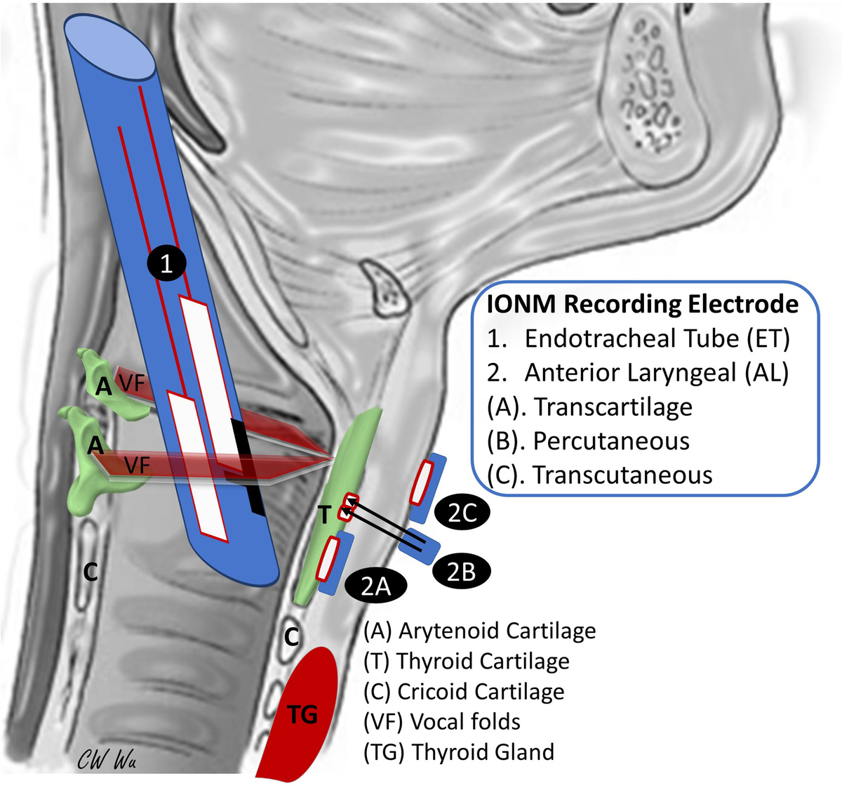 Frontiers | New Developments in Anterior Laryngeal Recording Technique ...
