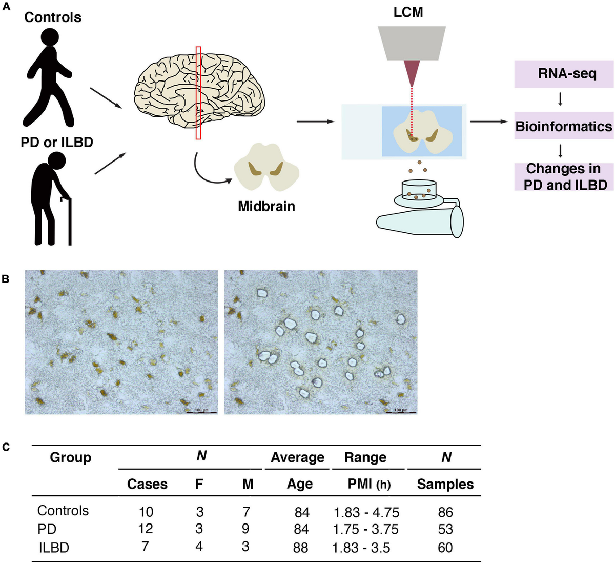 Frontiers | Disease Duration Influences Gene Expression in Neuromelanin ...