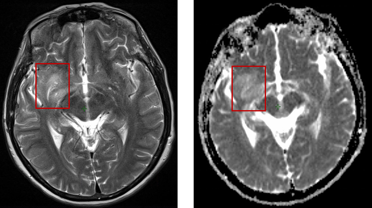 Frontiers | Medical Imaging Biomarker Discovery and Integration Towards ...