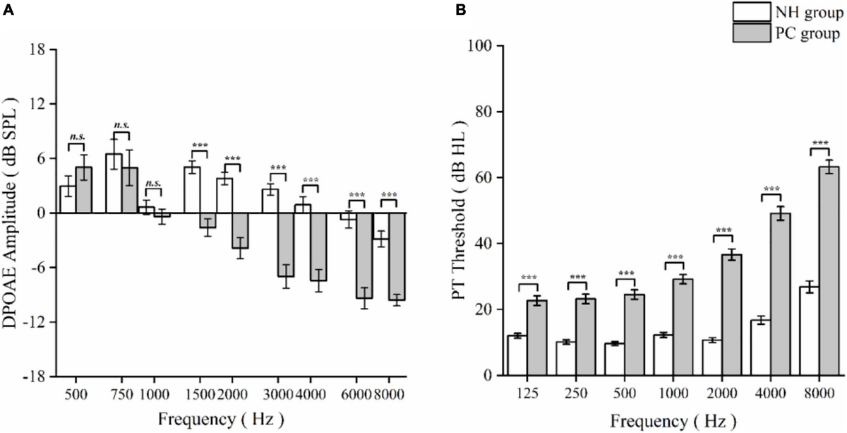 Frontiers | High-Frequency Cochlear Amplifier Dysfunction: A Dominating ...
