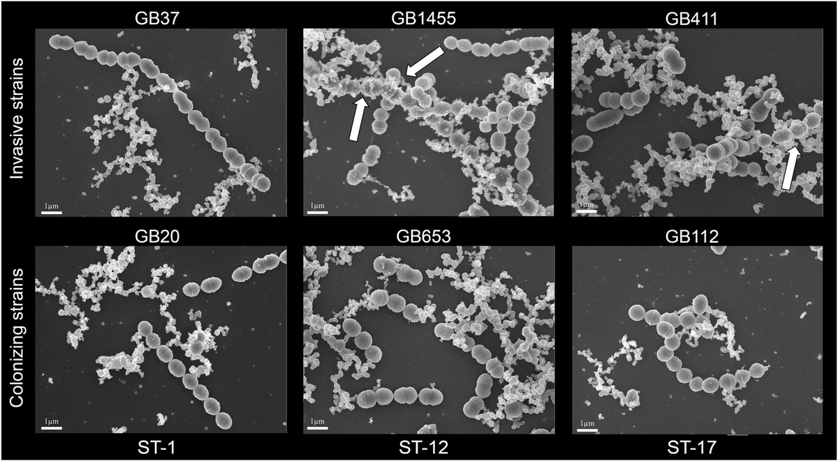 Frontiers | Production and Composition of Group B Streptococcal ...