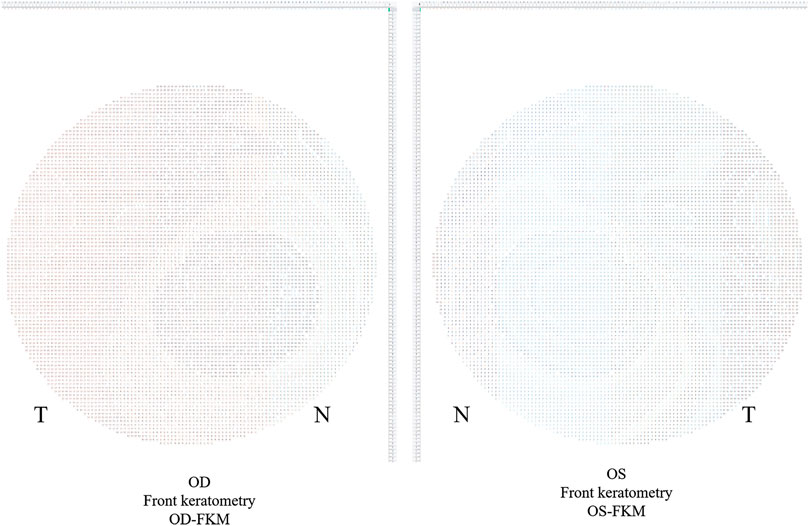 Frontiers | Bilateral Differential Topography—A Novel Topographic ...